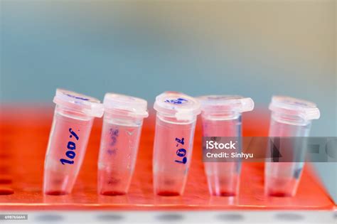 가스 믹서 샘플에 대 한 의료 장비 테스트 실험실에서 가스 크로마토그래피 에 대 한 유리병 건강 진단에 대한 스톡 사진 및 기타