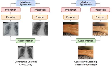 Review — Big Self Supervised Models Advance Medical Image Classification By Sik Ho Tsang Medium