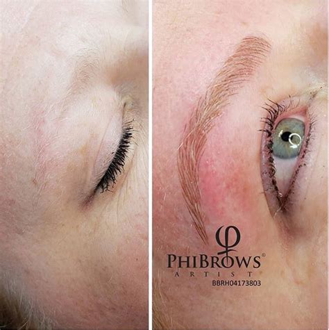 Lymphatic Drainage Skin Solution Hamilton