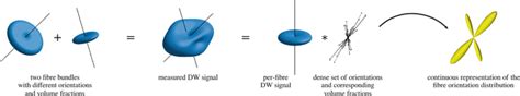High Angular Resolution Diffusion Imaging Radiology Key
