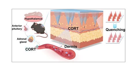 Lab On The Microneedles A Wearable Metalorganic Frameworks Based
