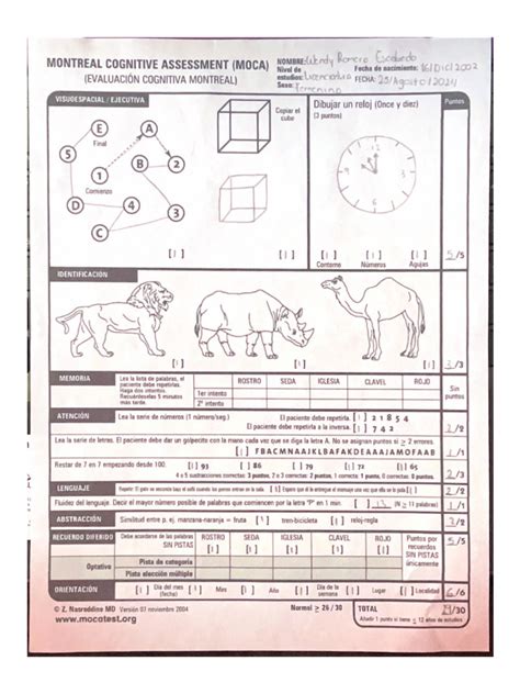 Montreal Cognitive Assessment Moca Pdf Montreal Cognitive Assessment Moca Pdf