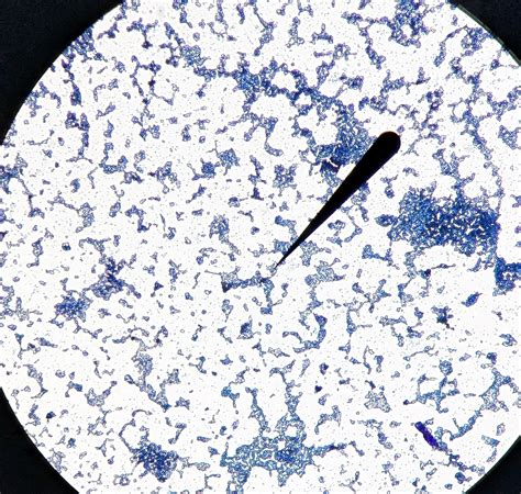 Staphylococcus Aureus Acid Fast Stain