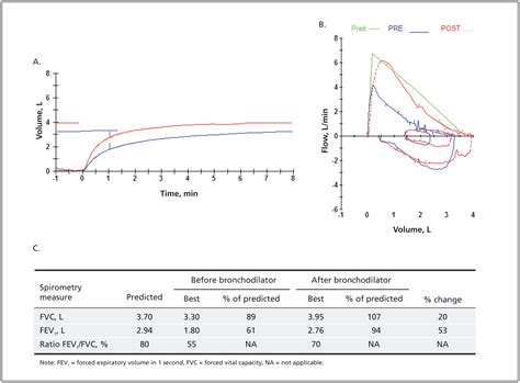Spirometry Graph At Douglas Hammond Blog