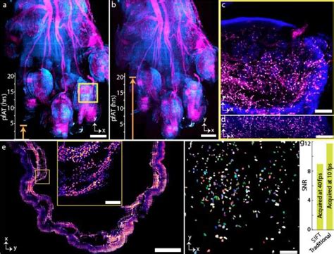 Microscopy Preprints New Tools And Techniques In Imaging Focalplane