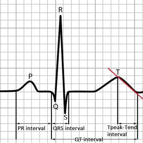 The Measurement Of Pr Qrs Qt And Tpeak To Tend Tp E Intervals On Ecg Download Scientific