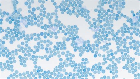 Image Processing Using Qupath Is It Possible Image Analysis Imagesc Forum