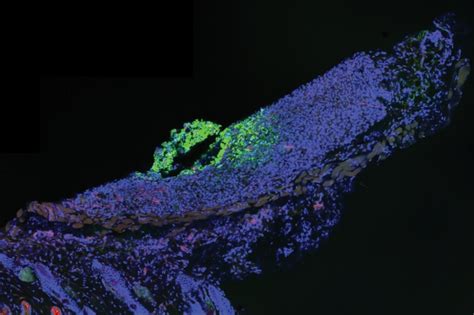 Synaptic Transistor Learns While It Computes