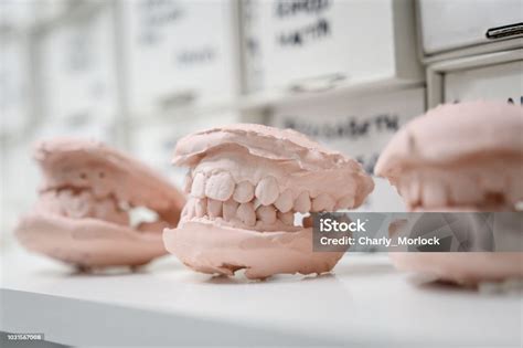 치과 주조 석고 모델 석고 캐스팅 치과 인간의 턱 Prothetic 실험실 기술 샷 3차원 형태에 대한 스톡 사진 및 기타 이미지 3차원 형태 입체 이미지 치아