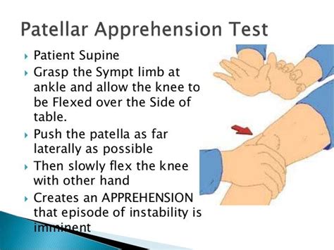 Patellar Tilt Test