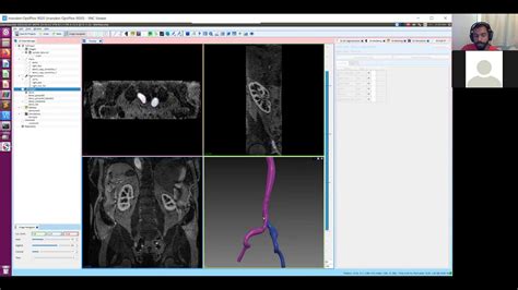 Simvascular Tutorial 5 Model Building Youtube