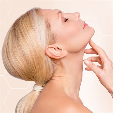 Renuva Dermal Filler Volume Loss Treatment Wellington