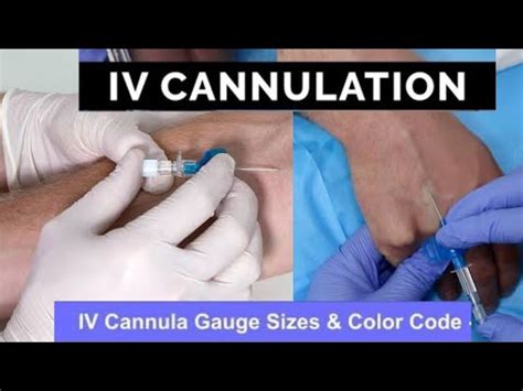 Cannula Insertion Technique Cannula Kaise Lagate Hain Cannula Types Size Colour