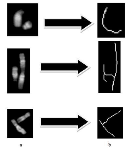 A The Different Of Touching Chromosomes Images B Is The Thinning Of
