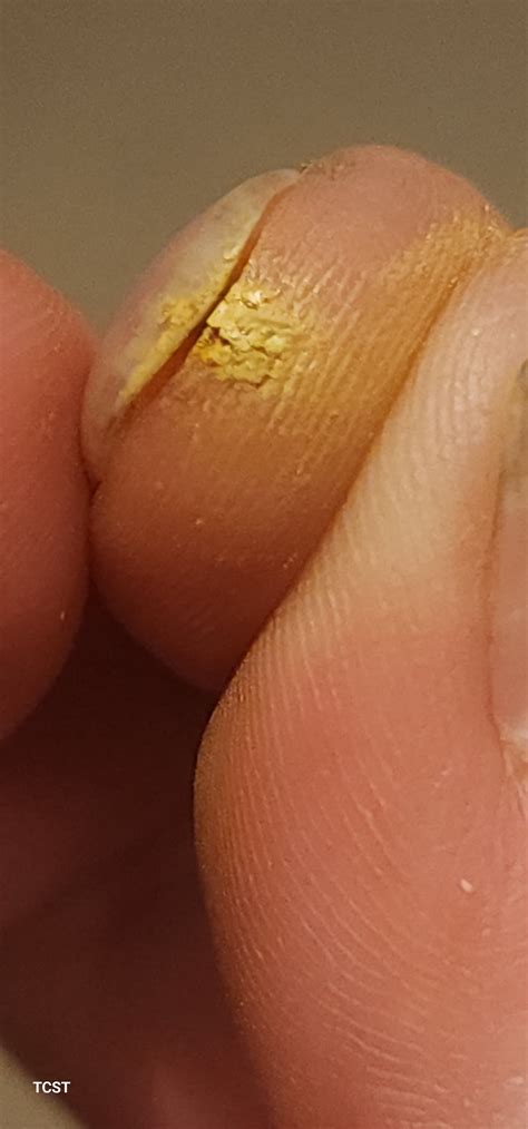 Is This Gold In Quartz Gem Related Discussion Igs Forums