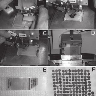 PDF Tissue Microarrays Construction And Uses