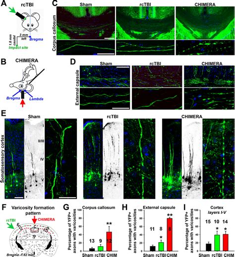 Different Spatial Patterns Of Axonal Varicosity Initiation In Rctbi And