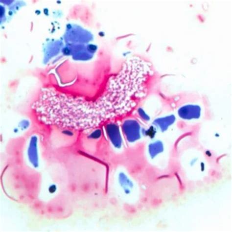 Grams Decolorizing Solution For The Gram Staining Method At Best Price