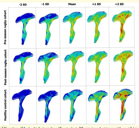 Figure 7 From Integration Of Diffusion Tensor Imaging Parameters With
