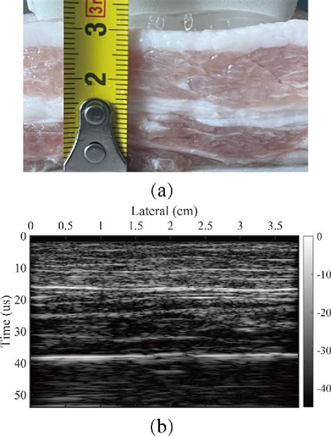 Figure 1 From Ultrasound Speed Of Sound Reconstruction Based On Local Event Slopes Of Synthetic