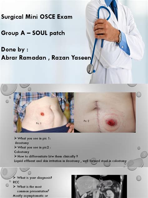 Mini Osce Surgery Group A Soul 2014 Pdf Colonoscopy Medical