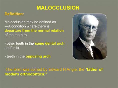 Classification Of Malocclusion Pptx