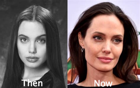 Angelina Jolie Plastic Surgery Before And After Photos