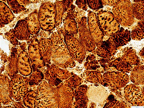 Cryptococcus