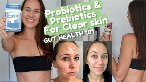 Probiotics For Acne How I Cleared My Skin Difference Between