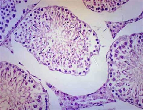 Section Through The Testis Of Control Mice Showing Normal Seminiferous Download Scientific
