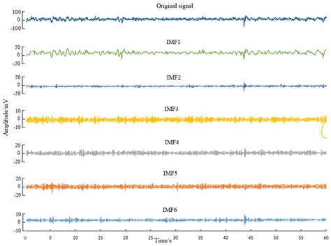 Epileptic Eeg Signal Detection Using Variational Modal Decomposition