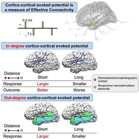 Effective Connectivity Relates Seizure Outcome To Electrode Placement In Hossein Shahabi