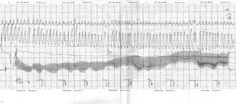 News News About Polygraphs Voice Stress Analyzers