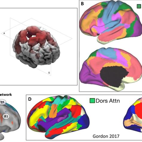 Pericentral Network A Sensorimotor Areas In 20 Left And 70 Right