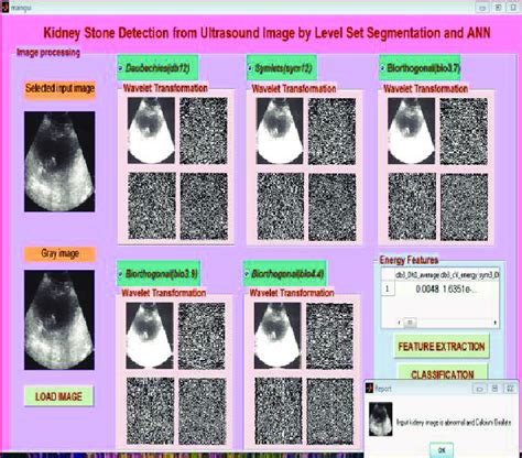lifting scheme wavelets subband decomposition energy feature