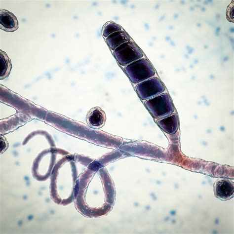 Diagnosis Of Dermatophytosis Amd Dermatomycosis