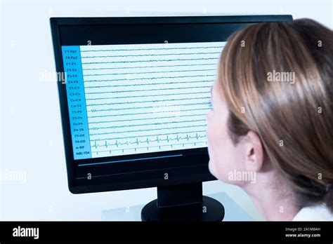 Female Medical Professional Looking At Eeg Electroencephalogram Results On A Screen Stock