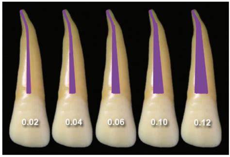 Preserving Tooth Structure — Key When Accessing Canals
