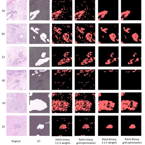 200301302 Gastric Histopathology Image Segmentation Using A Hierarchical Conditional Random