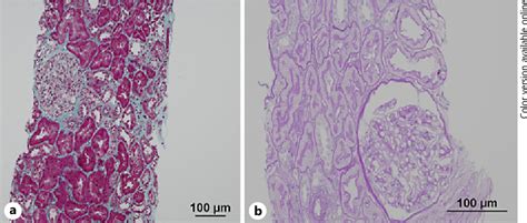 Figure 2 From Use Of Mixed Lymphocyte Reaction Assay To Evaluate Immune