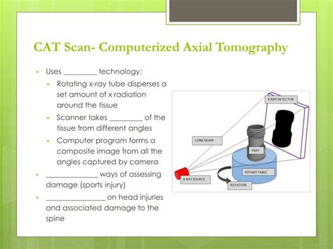 Ppt Mri Cat Scan Concussions Powerpoint Presentation Free Download