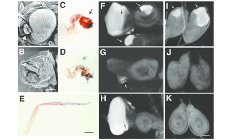 Eya Gene Function Is Essential For Ectopic Eye Formation By The Eyeless