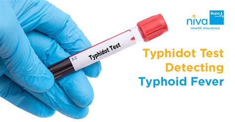 Typhidot Test Detecting Typhoid Fever