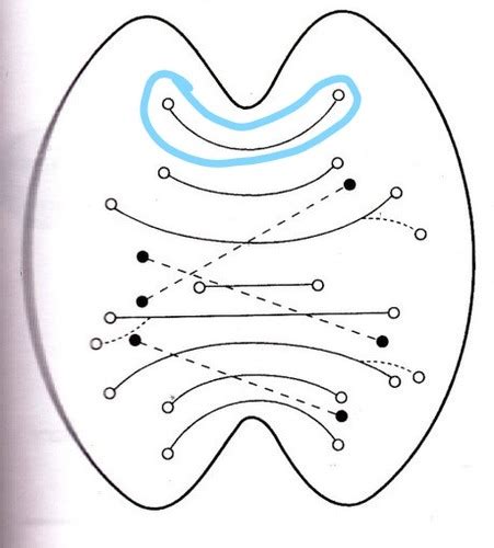 The Corpus Callosum And Auditory Interhemispheric Function Flashcards Quizlet