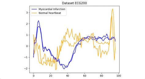 A Typical Example For Time Series Classification Given The Dataset Download Scientific