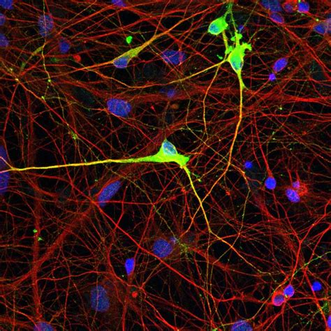 Novel Tool Confers Targeted Stable Editing Of Epigenome In Human Stem