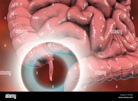 Appendix Hi Res Stock Photography And Images Alamy