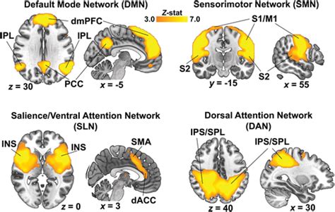 Intraparietal Sulcus Function