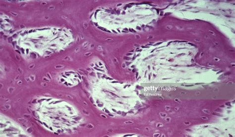 Spongy Or Cancellous Boneosteoblasts And Matrix 100x High Res Stock