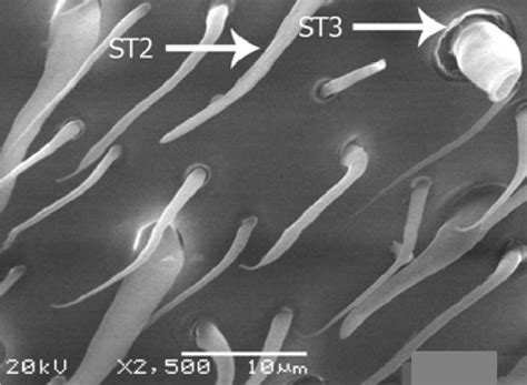 Scanning Electron Micrographs Of A Flagellomere Trichoidea 2 St2 And Download Scientific